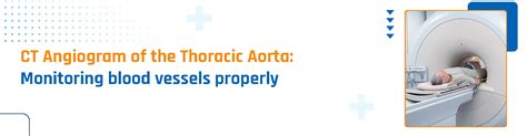 Ct Angiogram Of The Thoracic Aorta What Conditions Can It Detect