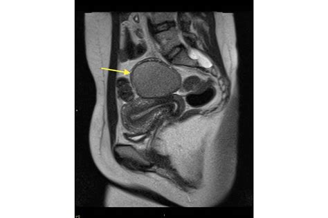 The Value Of Gbca In Mri Images Contemporary Obgyn