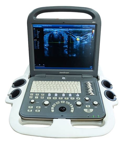 Ecografo Portatil Lcd 15″ Color 02 Transductores Lineal Y Convexo S2