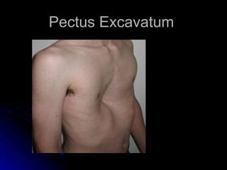 Examination In Paediatric Medicine Ppt