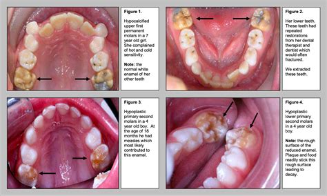 Back Molars Shop