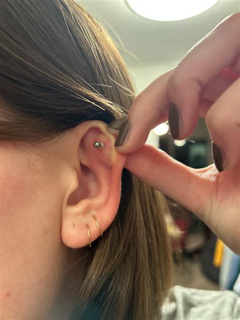 Piercing Bump Or Keloid Rpiercing
