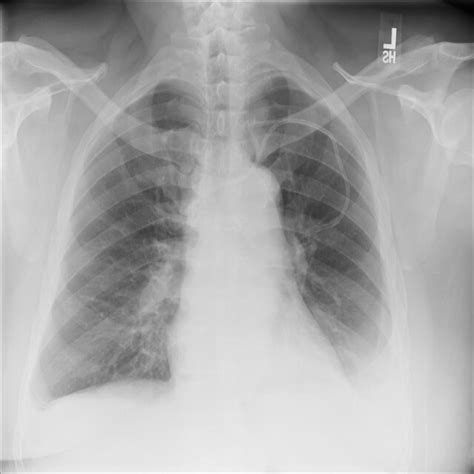 Detail Correction Path Download Scientific Diagram