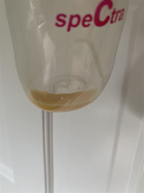 Is This Normal Breast Milk Color Rbreastfeeding