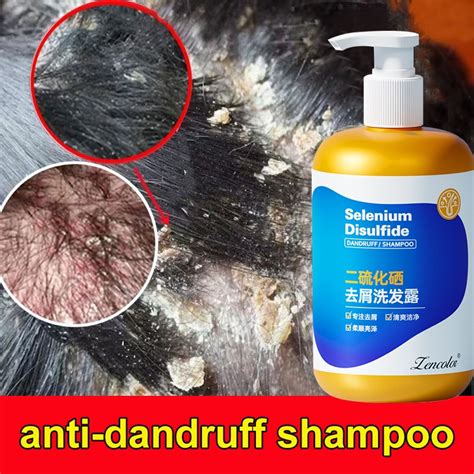 Shampoo Kelemumur Dandruff Shampoo Selenium Disulfide Anti Dandruff