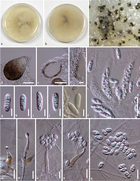 Plectosphaerella Kunmingensis Facesoffungi Number Fof 05716 Faces