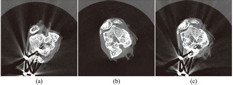 synthetic artifact image a the real artifact affected image b the
