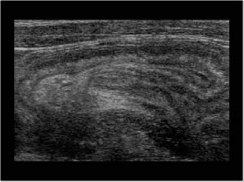 Pediatrics 91 Pediatric Abdomen And Retroperitoneum Case 912