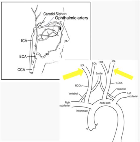 Intracranial And Extracranial Anatomy Flashcards Quizlet