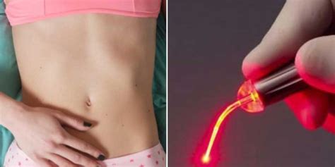 Can Lasers Improve Your Sex Life How Does Monalisa Touch Work