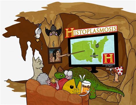 Histoplasmosis Osmosis