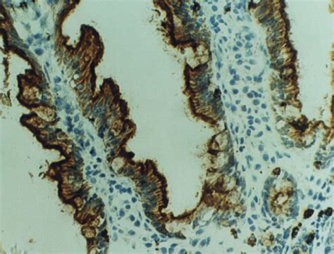 Lactase Persistence Cell Biology Evoed Evoed