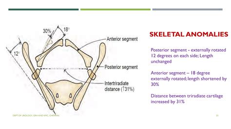 Pediatric Urology Bladder Extrophy And Epispadias Complex Pdf