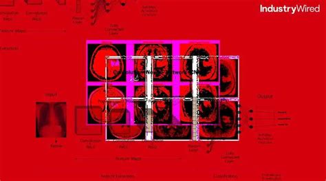 How Cnns Are Powering Breakthroughs In Medical Imaging