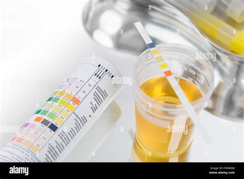 Routine Test Urine Rapid Test Urine Test Strip Urine Sample Stock