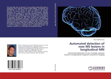 Automated Detection Of New Ms Lesions In Longitudinal Mri Automated Detection Of New Multiple