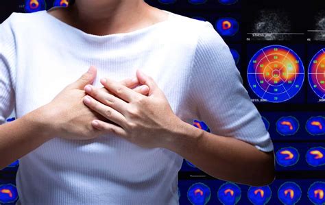 Multiple Sklerose Ms Symptome Diagnostik Therapie And Mehr