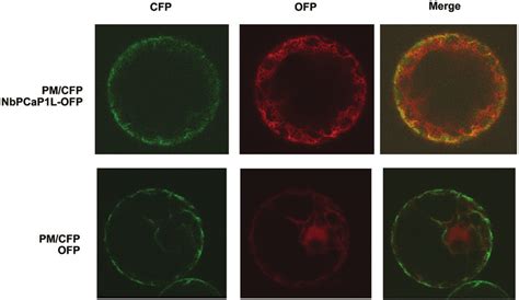 The Localization At The Plasma Membrane Pm And Cytoplasm Of Nbpcap1l