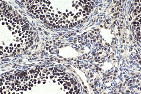 IHCeasy NACC1 Ready To Use IHC Kit KHC1882 Proteintech
