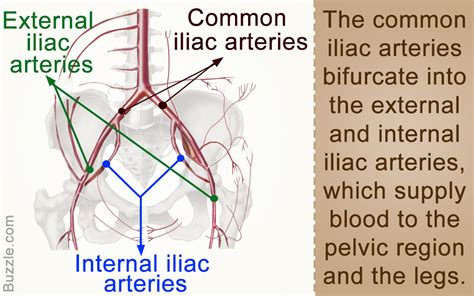 Common Iliac Artery