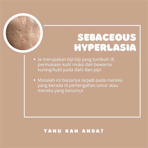 Klinikdrbazilah Nampak Biji Ni Macan Milia Atau