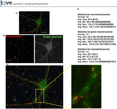 Quantification Of Synapse Number Using Puncta Analyzer Shown Here Is Download Scientific Quantification Of Synapse Number Using Puncta Analyzer Shown Here Is Download Scientific