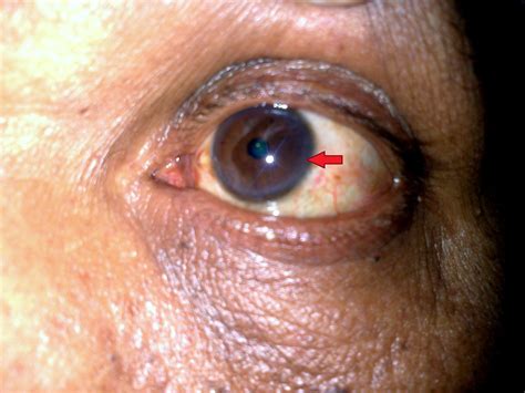 Eye “a Clue To Diagnosis” British Journal Of Medical Practitioners