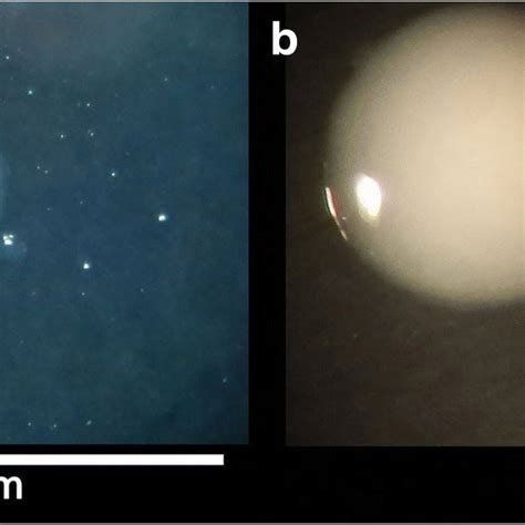 A Thirty Days Old White Punctiform Bacterial Colonies Red Arrows