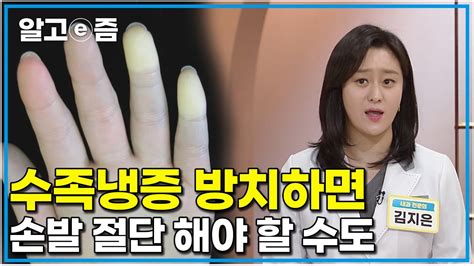 손발 차가워질 때 그냥 두다가 놓지고 마는 이 질환들 그냥 참고 두는 건 위험한 행동│일단 해봐요 생방송 오후 1시│알고e즘 Youtube
