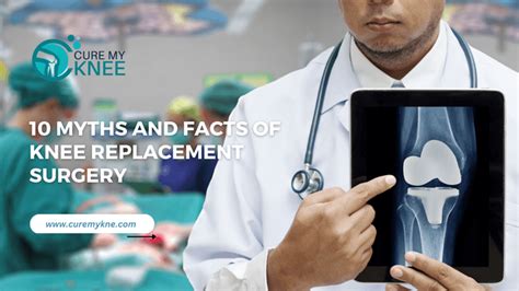 Know 10 Common Myths And Facts Of Knee Replacement Surgery