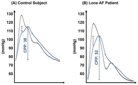 Examples Of Peripheral And Central Pulse Waveforms A Waveforms From