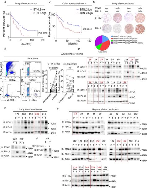 Cancer Cell Expressed Btnl2 Facilitates Tumour Immune Escape Via