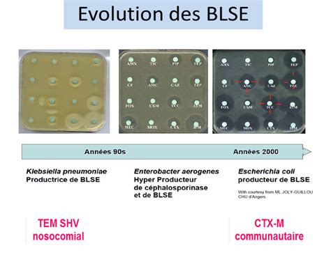 Epidémiologie Kit Blse