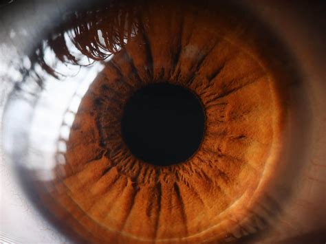 Cataract Surgery Lens Options Eduardo Besser Md