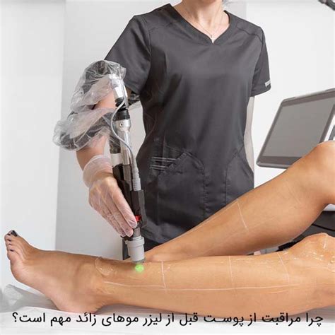 اقدامات و مراقبت‌های قبل و بعد از لیزر موهای زائد نکات آماده سازی