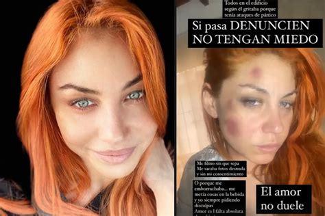 La Escalofriante Denuncia De Lourdes De Bandana Contra Su Expareja Y