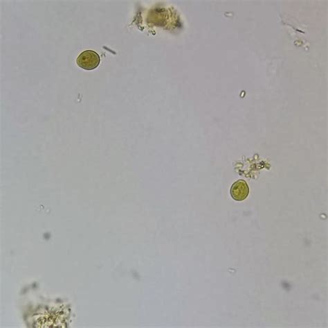 Labclinico Dg 𝗤𝗨𝗜𝗦𝗧𝗘 𝗗𝗘 𝘾𝙝𝙞𝙡𝙤𝙢𝙖𝙨𝙩𝙞𝙭 𝙢𝙚𝙨𝙣𝙞𝙡𝙞 🔬 Facebook