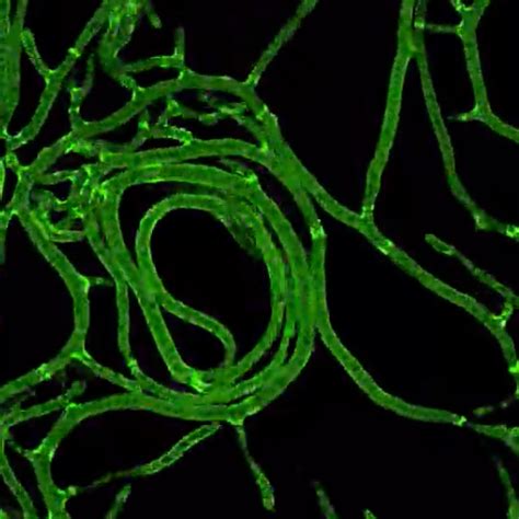 Cryptococcus Neoformans Dna Extraction Method