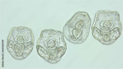 Larvae Sea Urchin Strongylocentrotus Pallidus Under Microscope Phylum