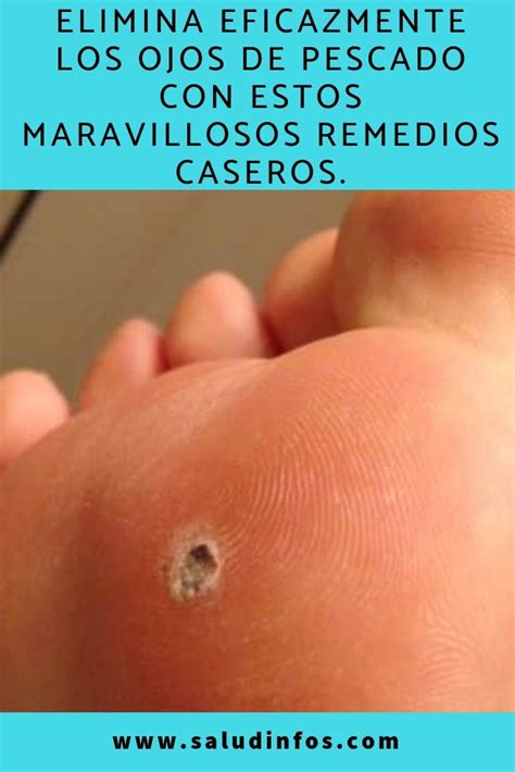 ¿cómo Limpiar Los Ojos De Pescado Iwkyz