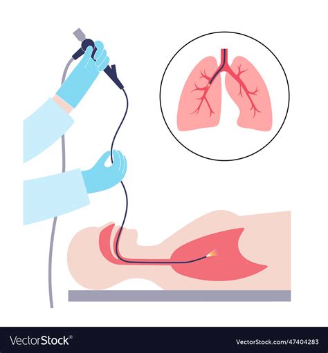 Bronchoscopy Procedure Concept Royalty Free Vector Image