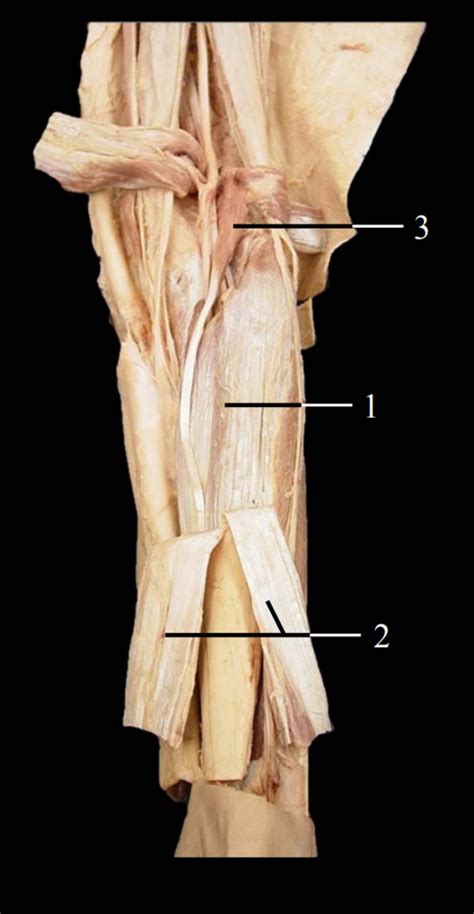 Popliteal Fossa 2 Diagram Quizlet
