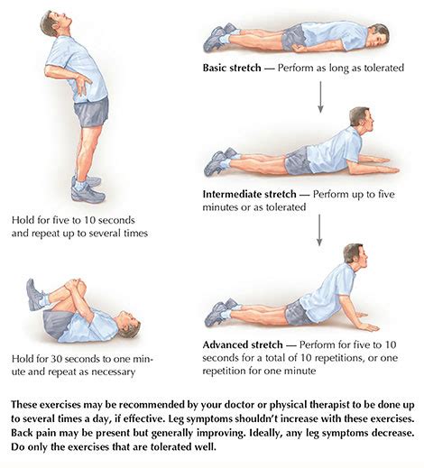 8 Ways To Treat Sciatica Naturally Home Cures That Work