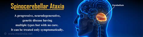 Spinocerebellar Ataxia Types Causes Symptoms Diagnosis Treatment