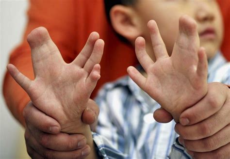 Chilling Images Of Human Mutation Across The World PHOTOS Mutation