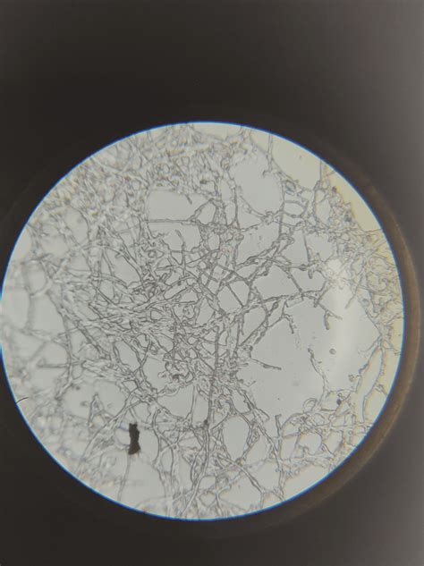 Is This Scoby R Kombucha