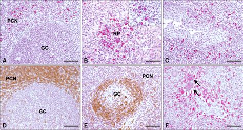 Immunohistochemical Results Showing Expression Of Interukin Il 10