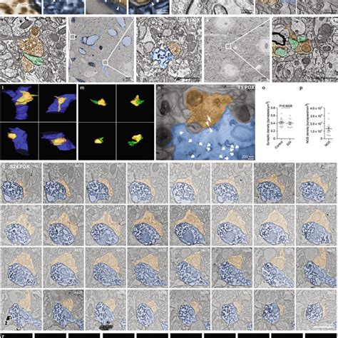 Ngs Classification In Pdx Glioma Models And Human Tumour Samples Ac