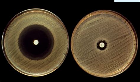 科学网—[转载]《自然》杂志：抗生素耐药性是一个日益严重的威胁——气候变化是否使情况变得更糟 李中平的博文