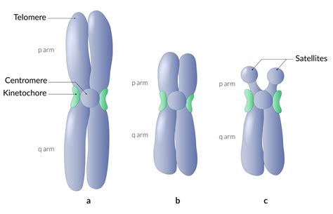 Albinism Karyotype